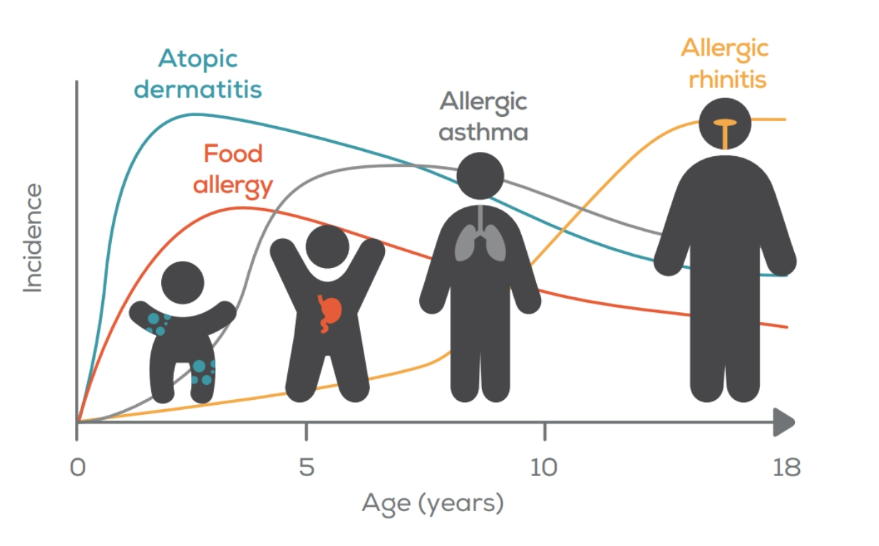 Food Allergies in Infants | Mead Johnson HCP